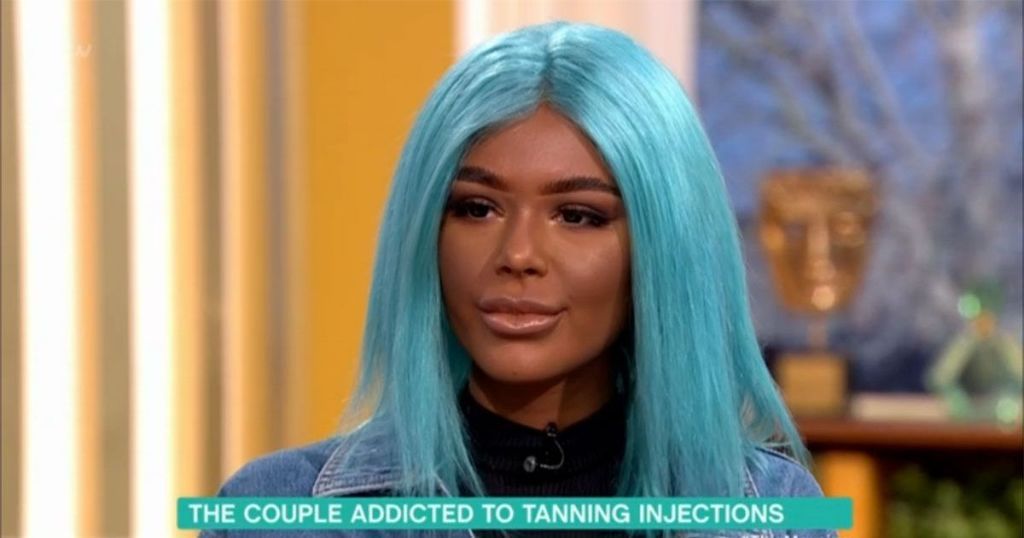 This Morning couple addicted to tanning injections…