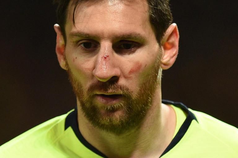 Barcelona star Lionel Messi left bleeding from nose…