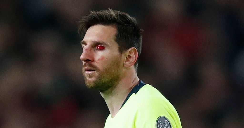 Severity of Lionel Messi nose injury after Chris…