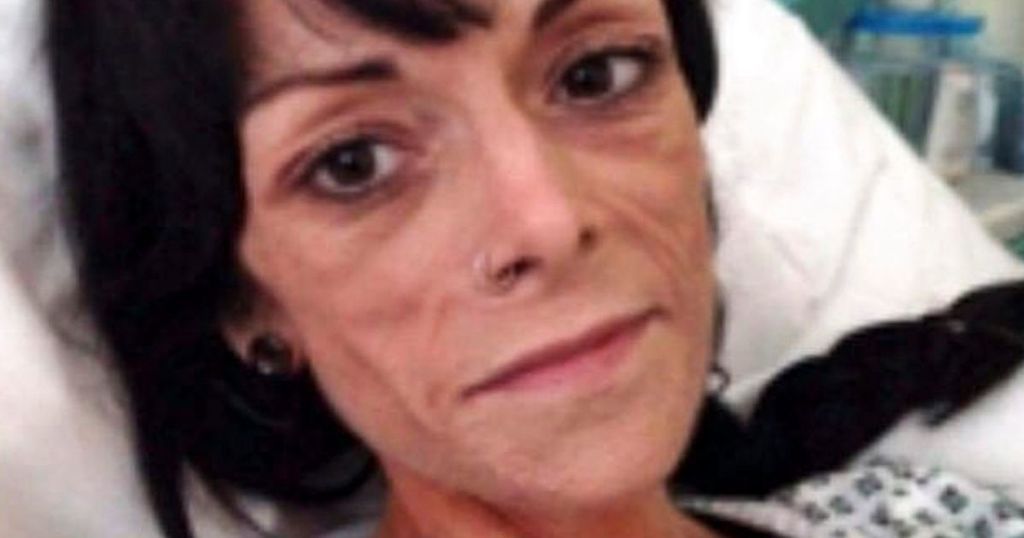 Mum's intestines 'EXPLODE' through C-section scar and…