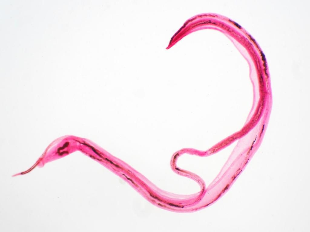 8,000-year-old intestinal parasite reveals toilet…