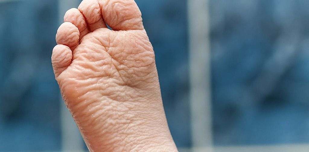 Curious Kids: why do our toes and fingers get wrinkly…