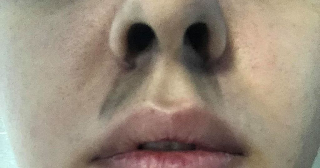 Woman nearly died from soot in lungs after leaving…