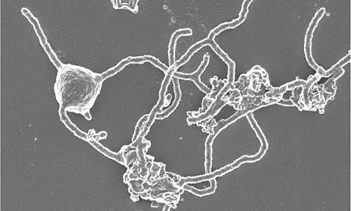 Breakthrough gives insight into early complex life on…