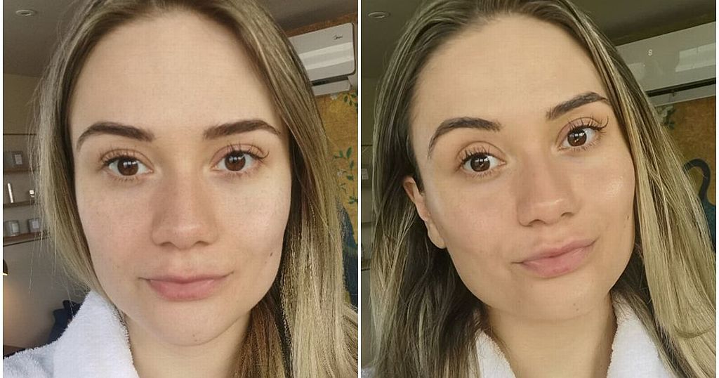 We tried the 'world's best' 3D collagen shock facial…