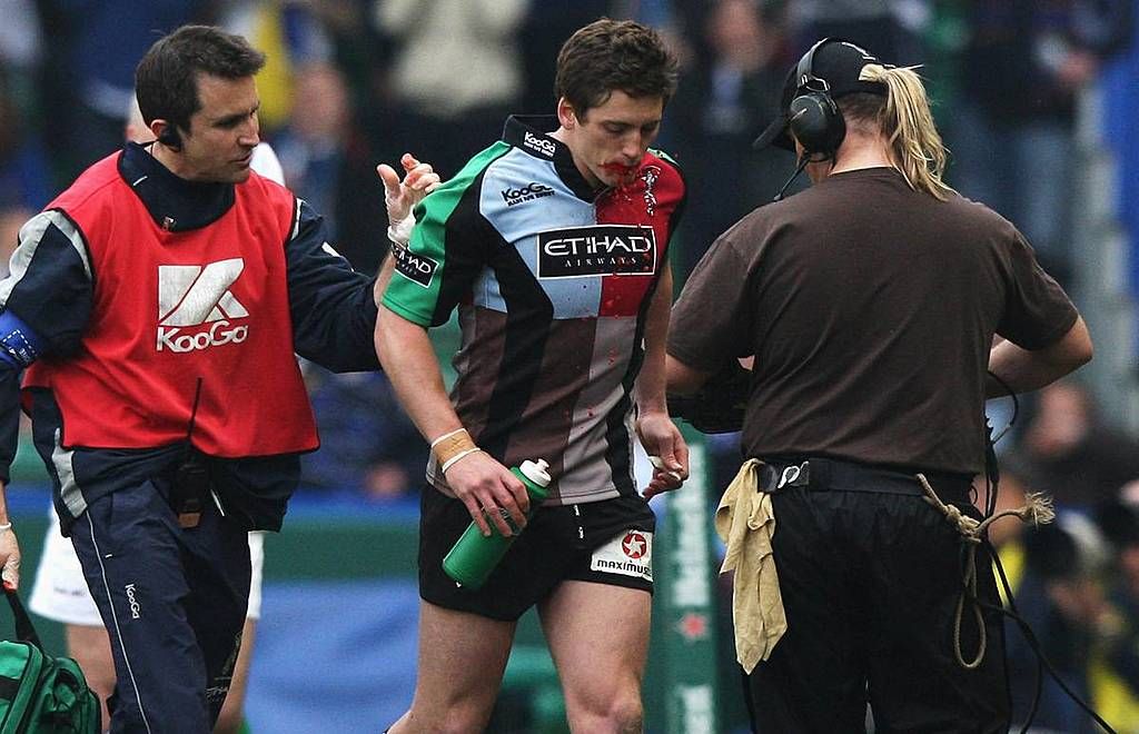 Rugby: Biting, eye-gouging and ref abuse - the longest…