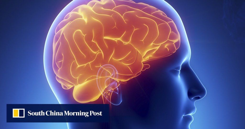 The brain: how it works and the best ways to keep it…