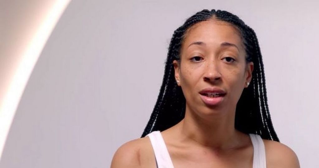 Shocking story behind contestant on Netflix's Skin…