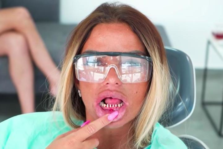 Katie Price reveals gruesome look at teeth…