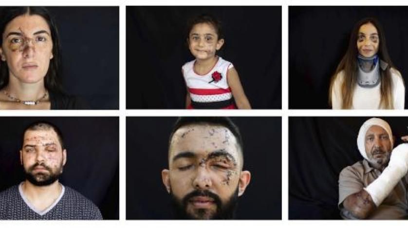Scars From Beirut Blast Capture Moment of Horror